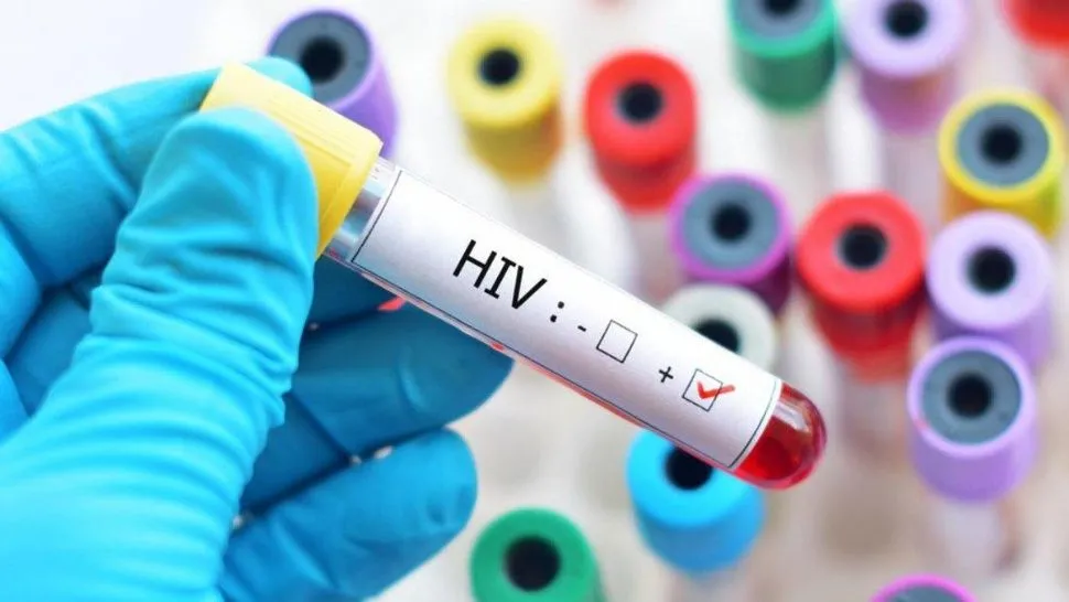 HIV